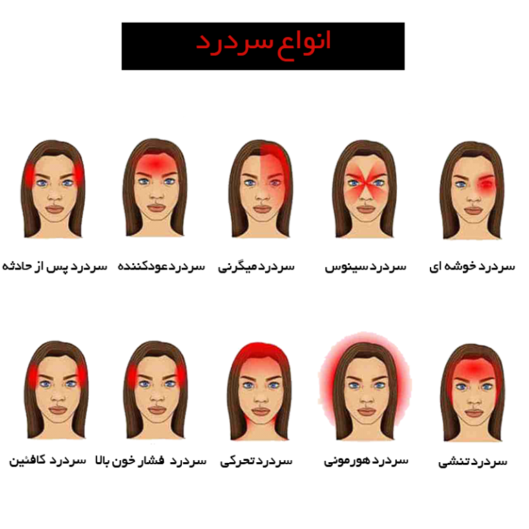 با انواع سردرد آشنا شوید - وبگاه دکتر رضا زارع